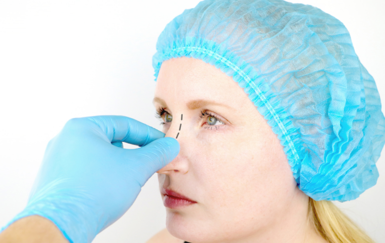 Dime que nariz tienes y te diré qué tipo de rinoplastia necesitas - Dr ...